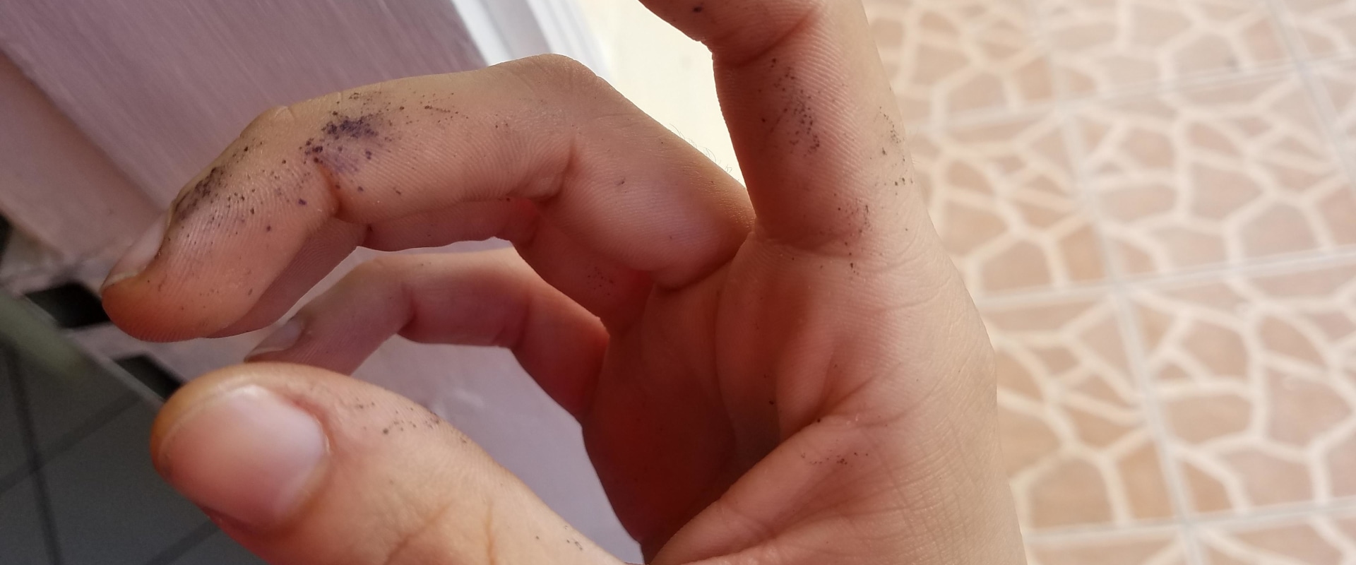 The Science Behind Silver Nitrate Stains on Skin