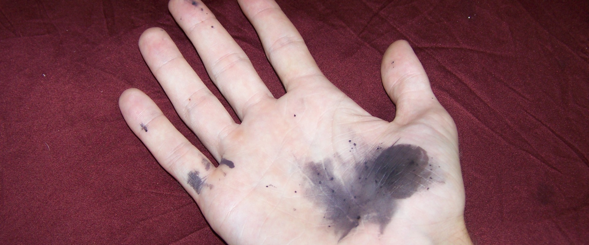 The Hidden Dangers of Silver Nitrate on Skin